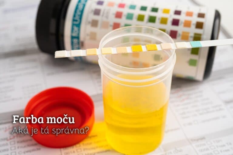Aká je správna farba moču a čo môže prezradiť? - MojaProstata.sk